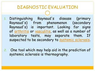 Raynaud's disease | PPTX