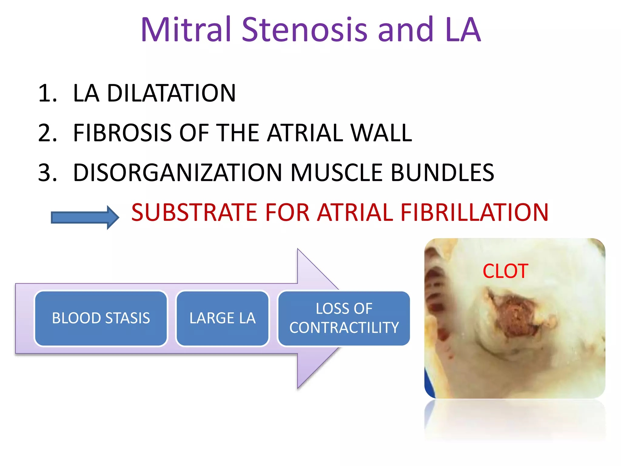 Mitral valve pathophysiology | PPTX | Heart and Cardiovascular Diseases ...