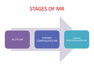 Mitral valve pathophysiology | PPTX