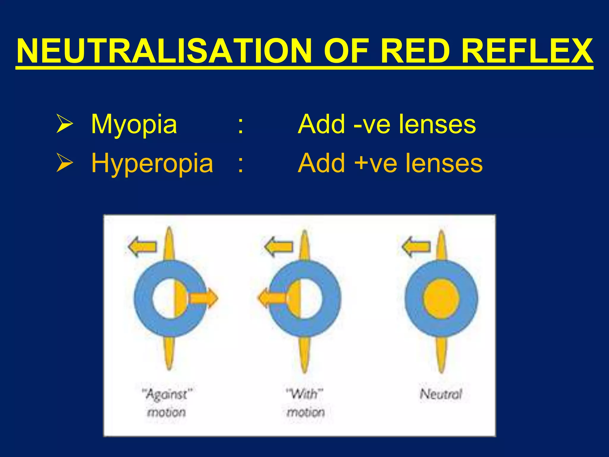 Clinical refraction | PPT