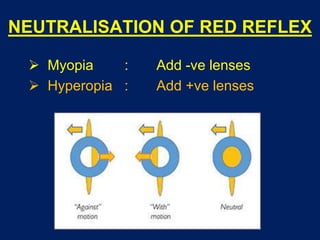 Clinical refraction | PPT