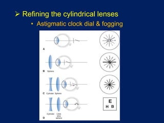 Clinical refraction | PPT