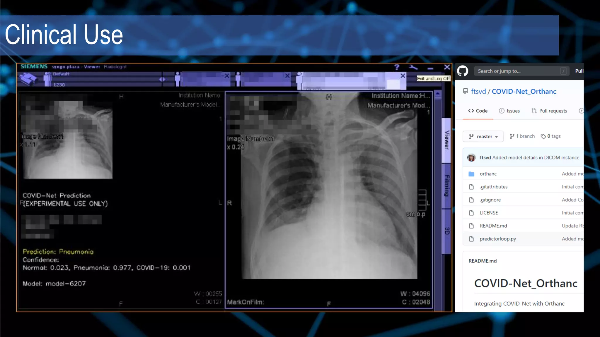 Multi-Centre Optimization and Validation of an Open Deep Learning Model for COVID-19 Detection ...