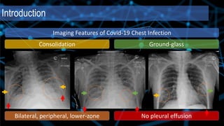 Multi-Centre Optimization and Validation of an Open Deep Learning Model ...