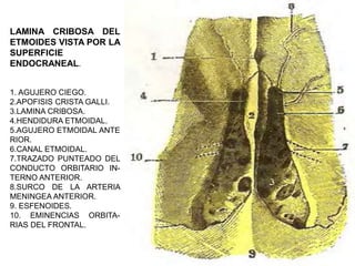 2. hueso etmoides | PPTX