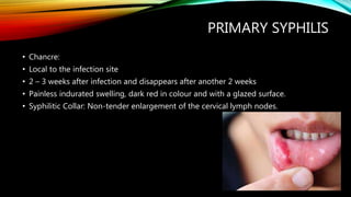 Bacterial Infections of Oral Mucosa | PPTX