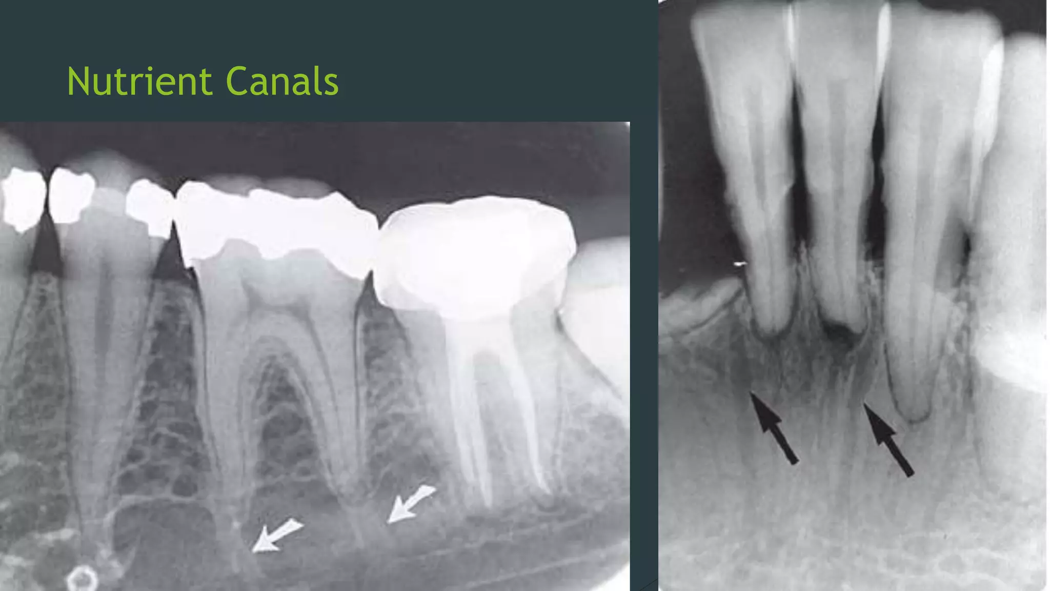 Normal Radiographic Anatomy of Oral Structures | PPTX