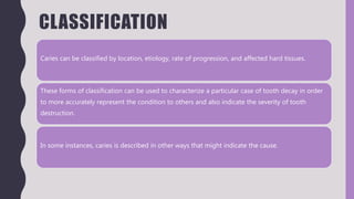 dental caries #2 | PPT