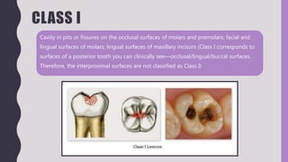 dental caries #2 | PPT