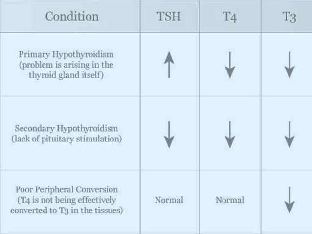 Hypothyroidism: Evaluation & Management by Dr Selim | PPT | Thyroid ...