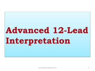 2. advanced 12 lead ecg interpretation by sammy | PPTX