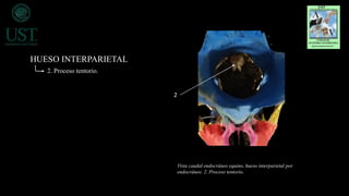 Osteología de neurocraneo de equino | PDF