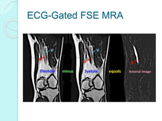 Phase Contrast and ECG-Gated MRA | PPTX