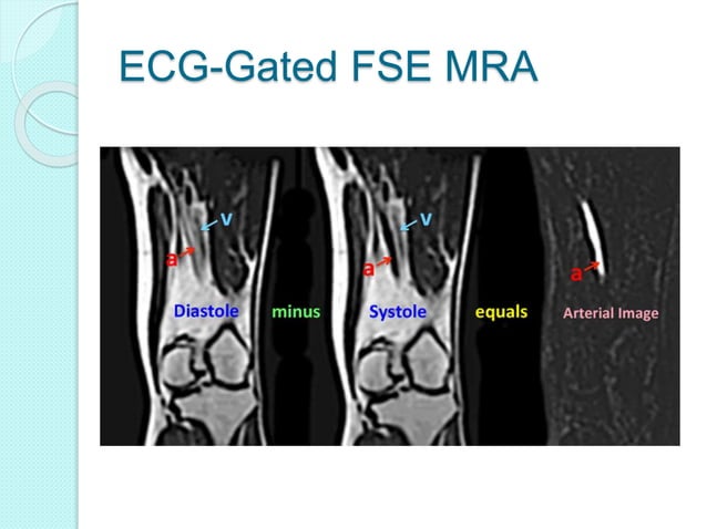 Phase Contrast and ECG-Gated MRA | PPTX | Medical Tests | Medical Health