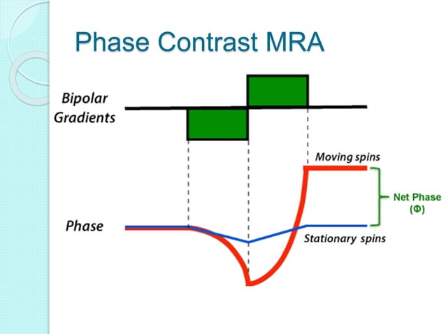 Phase Contrast and ECG-Gated MRA | PPTX | Medical Tests | Medical Health
