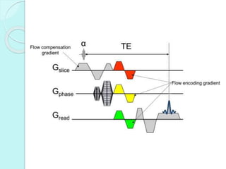 Phase Contrast and ECG-Gated MRA | PPTX