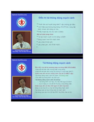 BỆNH ĐỘNG MẠCH VÀNH | PDF