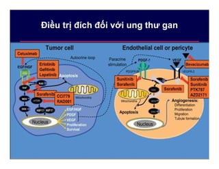 UNG THƯ TẾ BÀO GAN NGUYÊN PHÁT | PDF