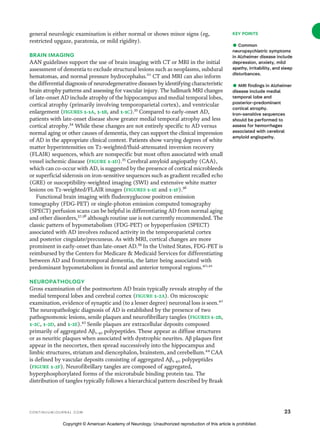 2. late onset alzheimer disease | PDF