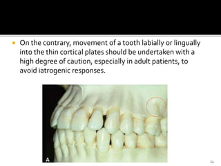 BIOLOGY OF TOOTH MOVEMENT | PPTX