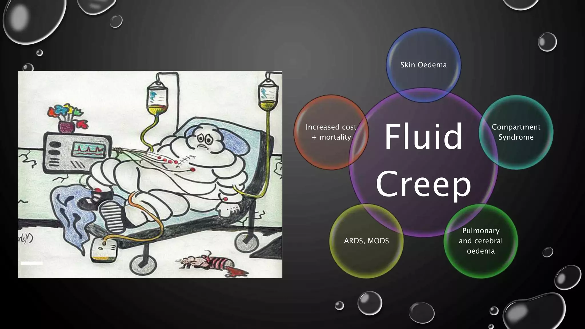 Burns Fluid Resuscitation | PPTX