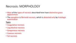 2. cell injury and cell death | PPT