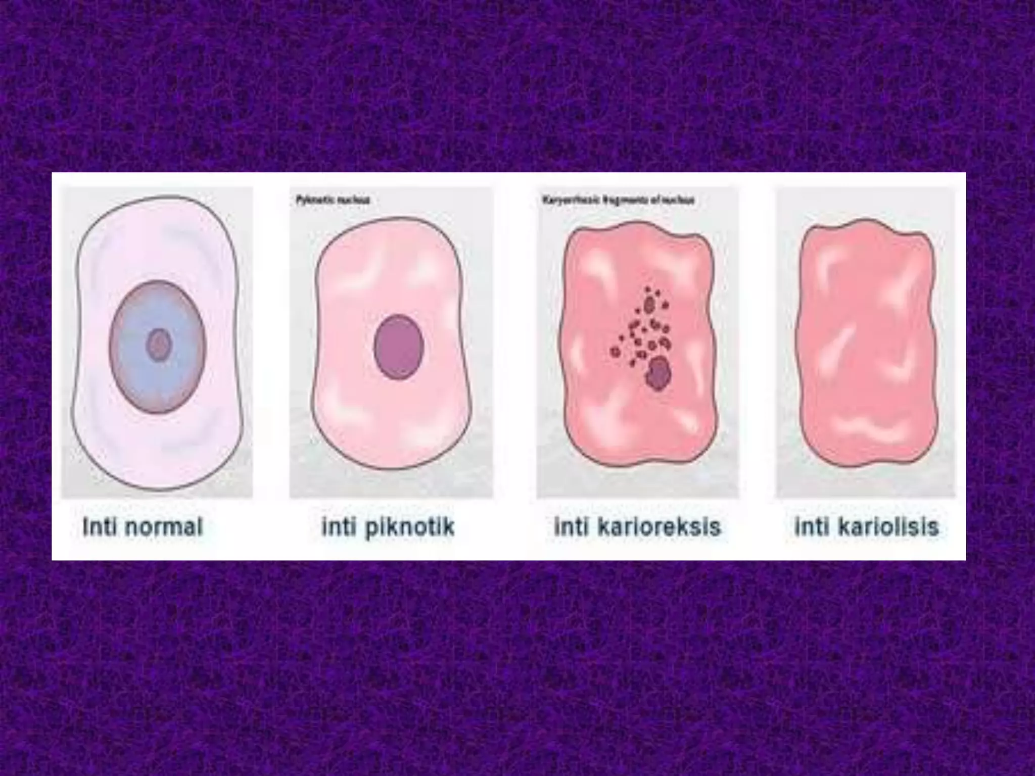 Kematian Jaringan Dan Nekrosis Sel Pptx