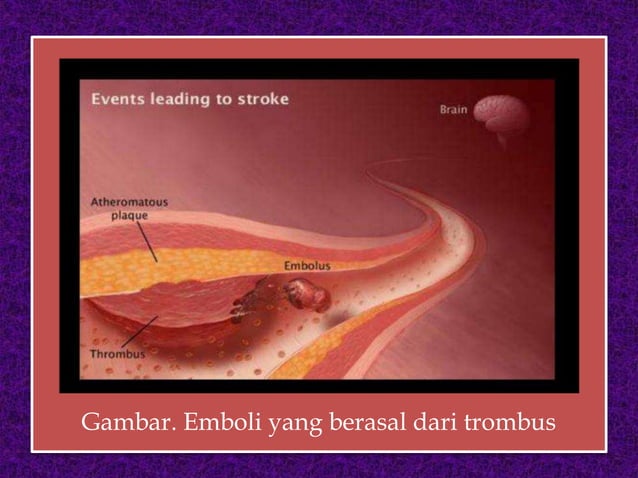 kematian jaringan dan nekrosis sel | PPTX