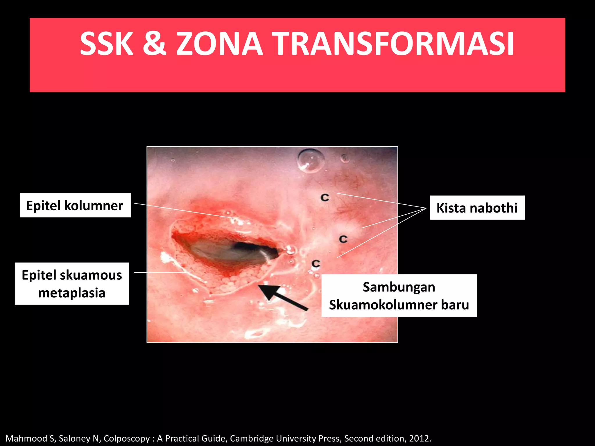 anatomi histologi serviks | PPTX