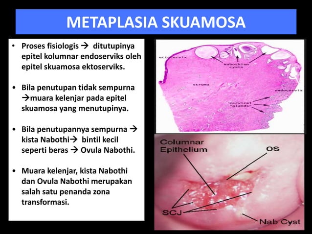 anatomi histologi serviks | PPTX