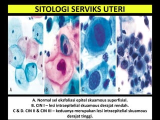 anatomi histologi serviks | PPTX