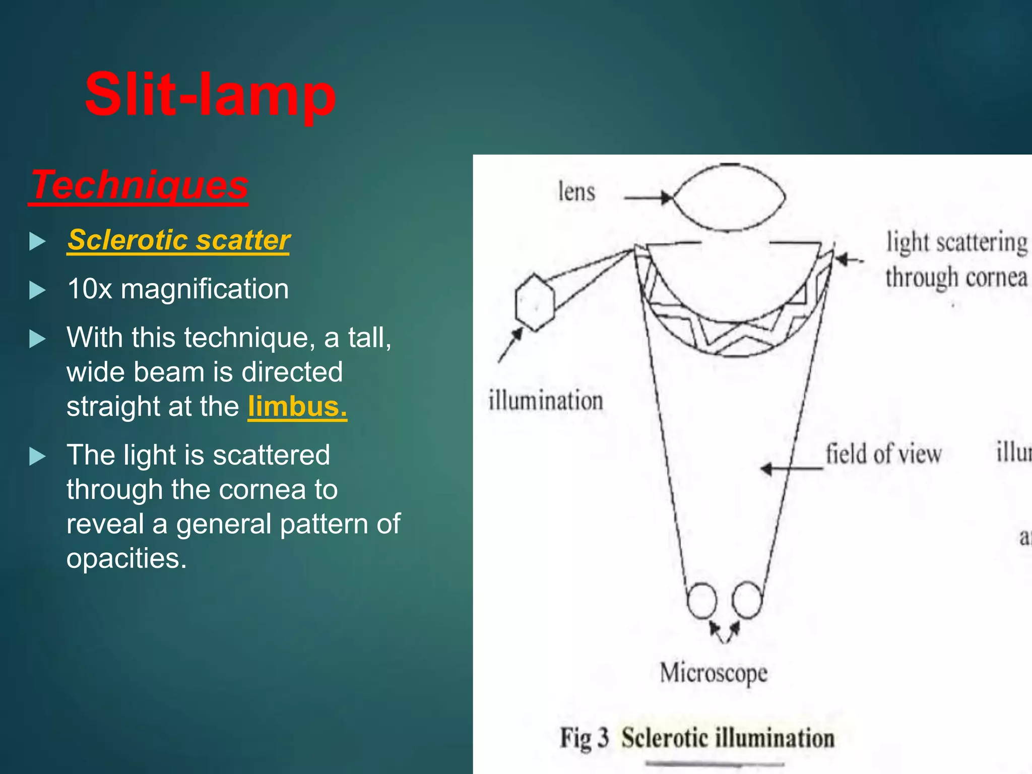 2.ophthalmology workup.2 | PPTX