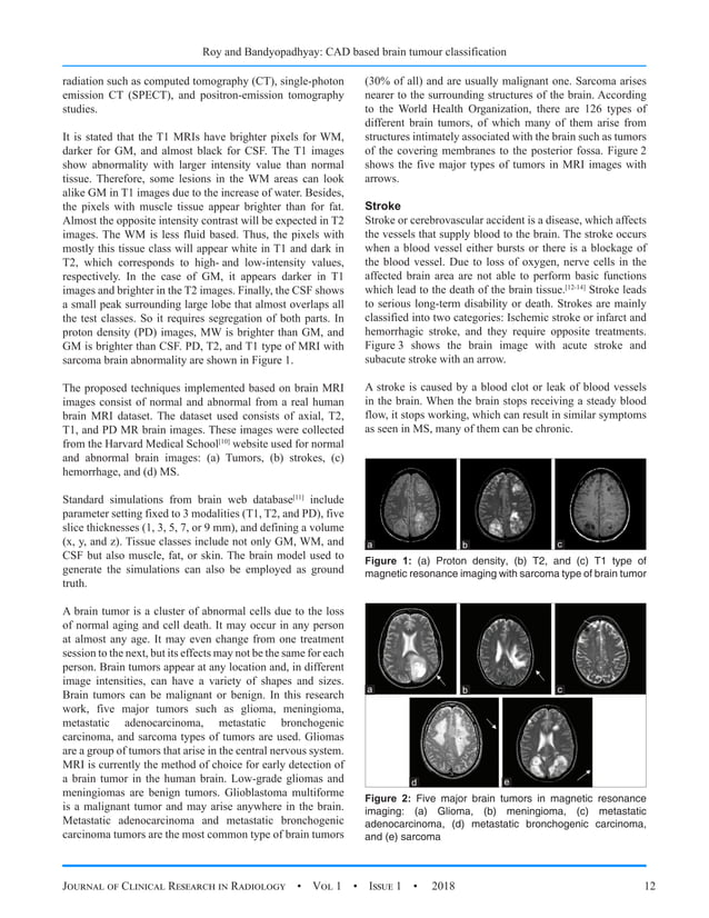 Description of Different Phases of Brain Tumor Classification | PDF