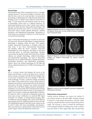 Description of Different Phases of Brain Tumor Classification | PDF