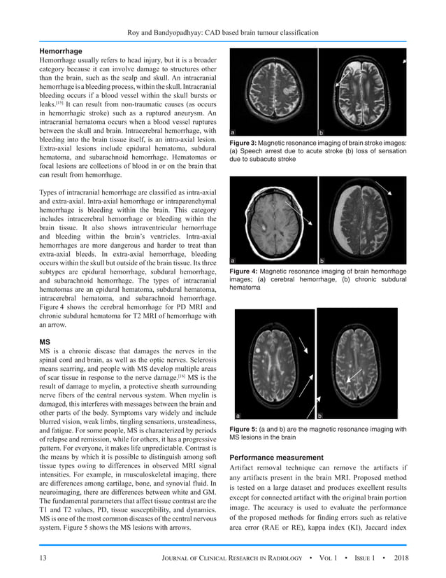 Description of Different Phases of Brain Tumor Classification | PDF