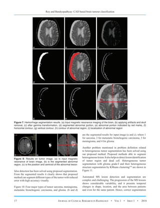 Description of Different Phases of Brain Tumor Classification | PDF