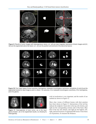 Description of Different Phases of Brain Tumor Classification | PDF