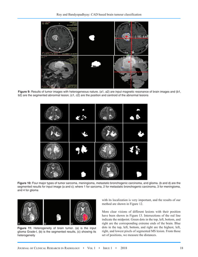 Description of Different Phases of Brain Tumor Classification | PDF