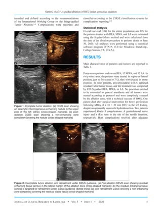Thermal Ablation of Renal Tumors under Ultrasound Guidance and ...
