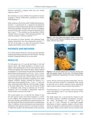 Brain Imaging Abnormalities in Autism Disorders | PDF