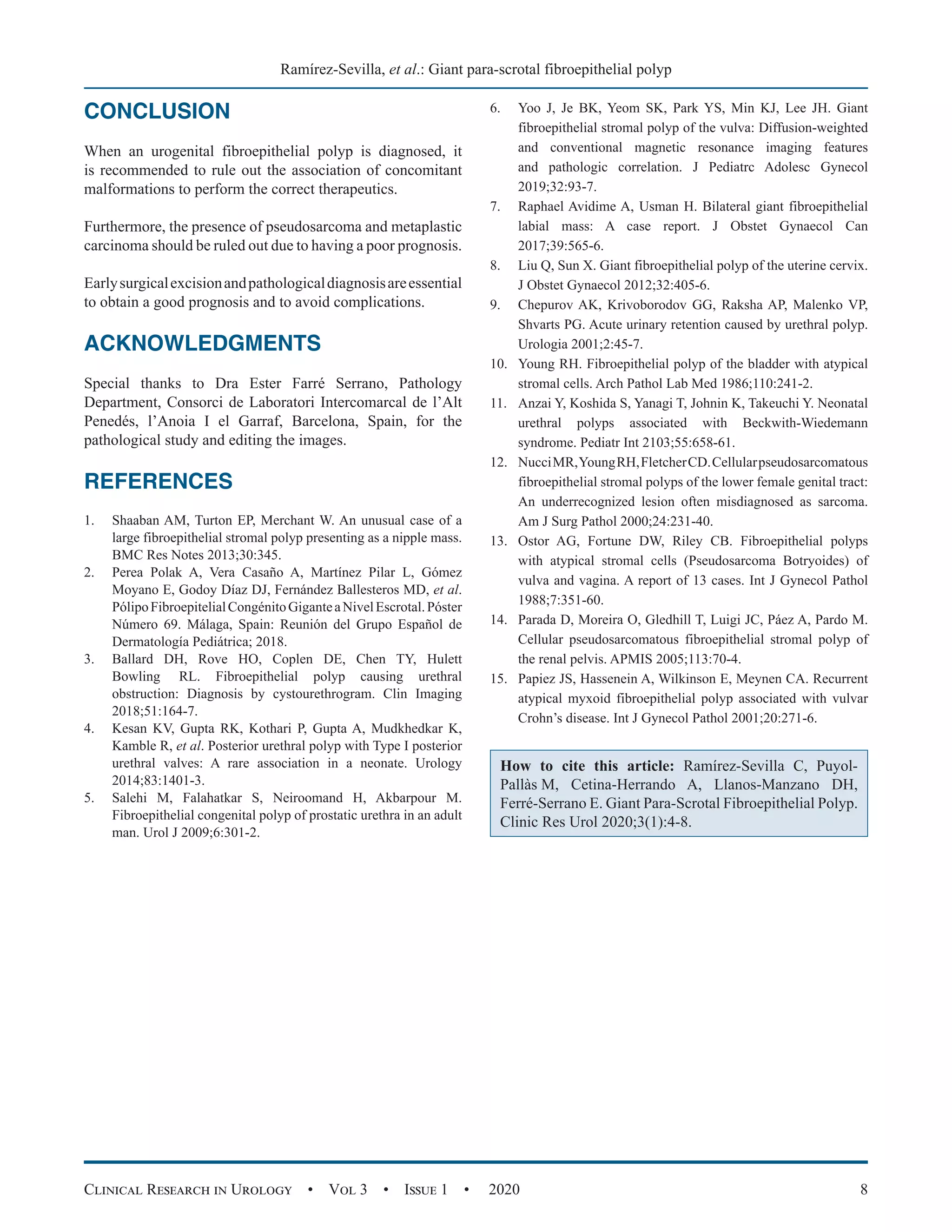 Giant Para-scrotal Fibroepithelial Polyp | PDF
