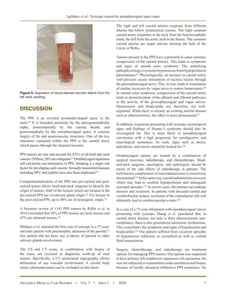 A Sinister Cause for Recurrent Syncope: Metastatic Parapharyngeal Space ...