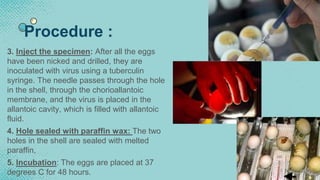 CULTIVATION OF VIRUS : Embryonated eggs | PPTX