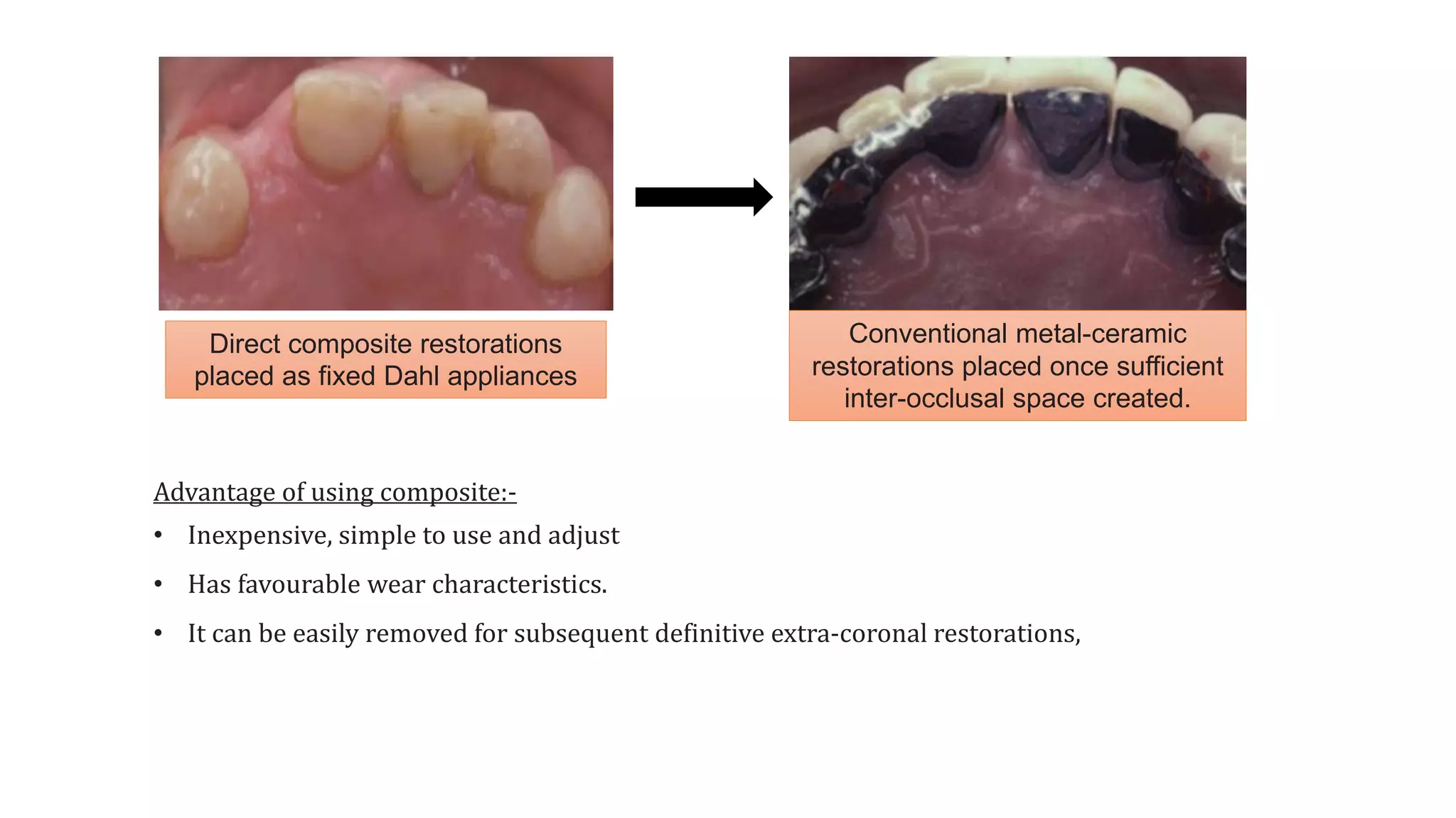 NON CARIOUS LESIONS | PPTX