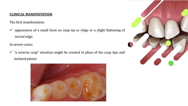 NON CARIOUS LESIONS | PPTX | Oral care | Personal Care