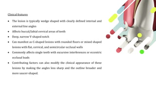 NON CARIOUS LESIONS | PPTX
