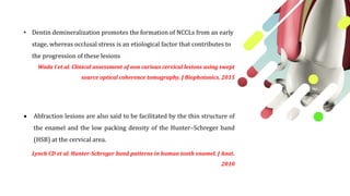 NON CARIOUS LESIONS | PPTX