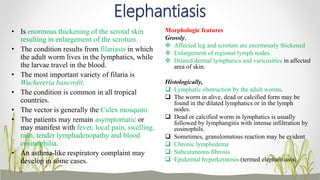 2. PATHOLOGIES OF THE TESTIS & EPIDIDYMIS.pptx
