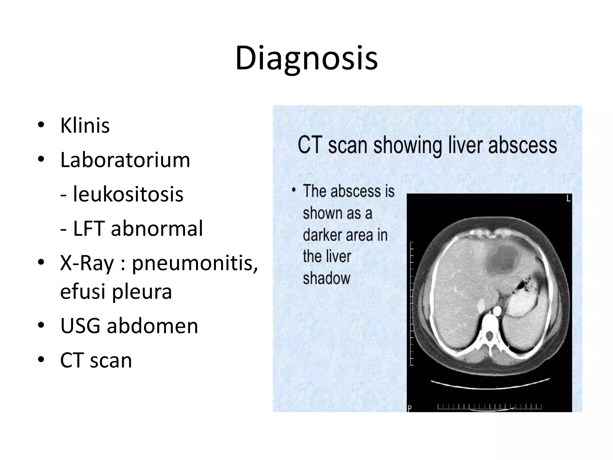 2.4.4.4b Abses Hati.pptx