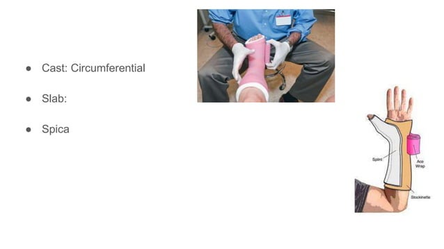 Orthopaedic terminology | PPTX